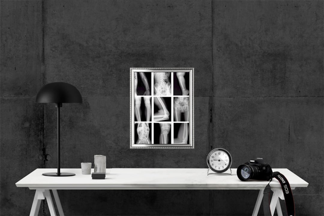 Skeleton Human Anatomy Xrays Clipart Body Parts Collage Sheet Digital ...