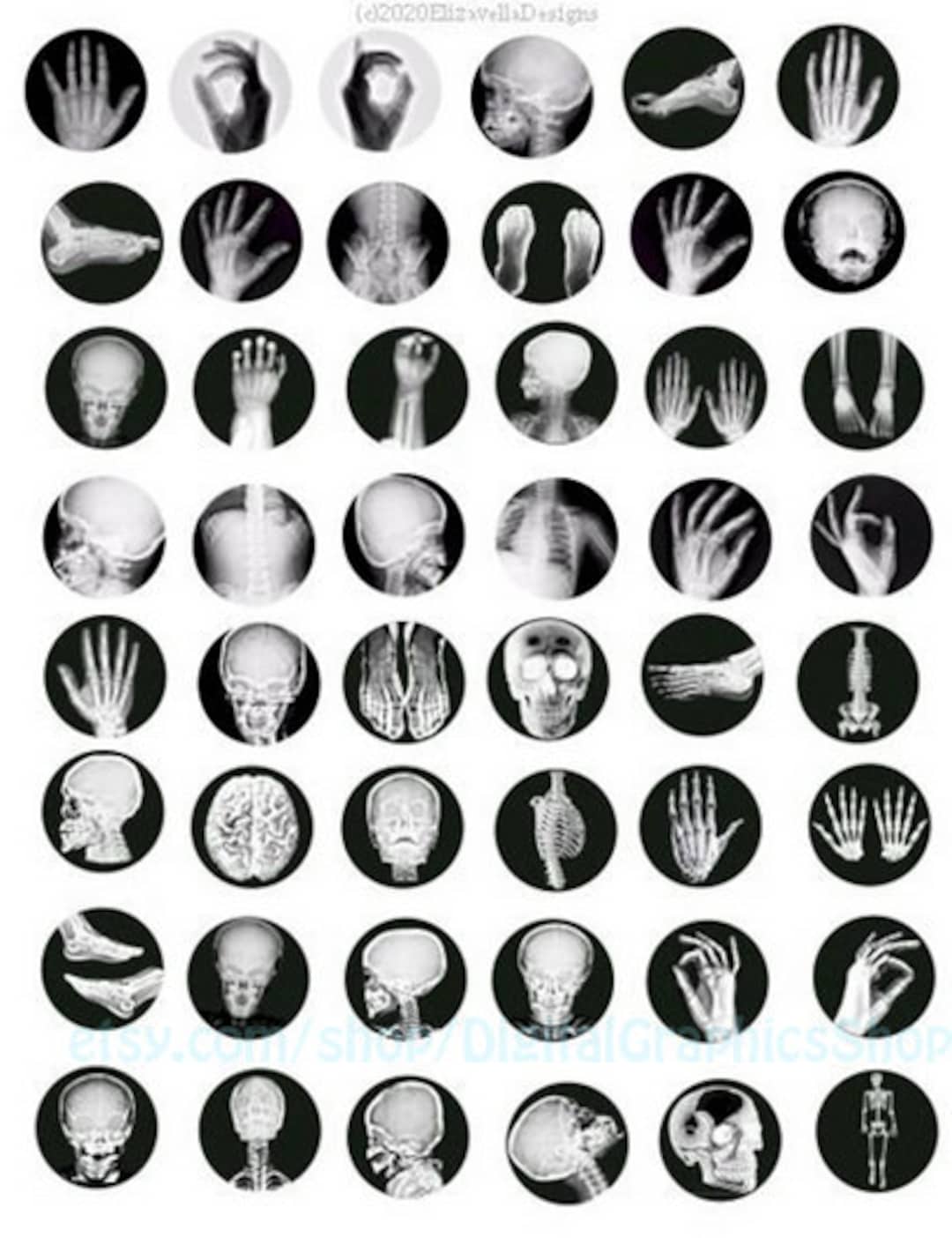 Human Anatomy Skeleton Xray Pictures 1 Inch Circles Collage Sheet ...