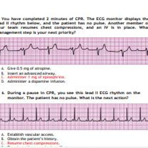 ACLS Exam Version C Advanced Cardiovascular Life Support Exam Version C ...