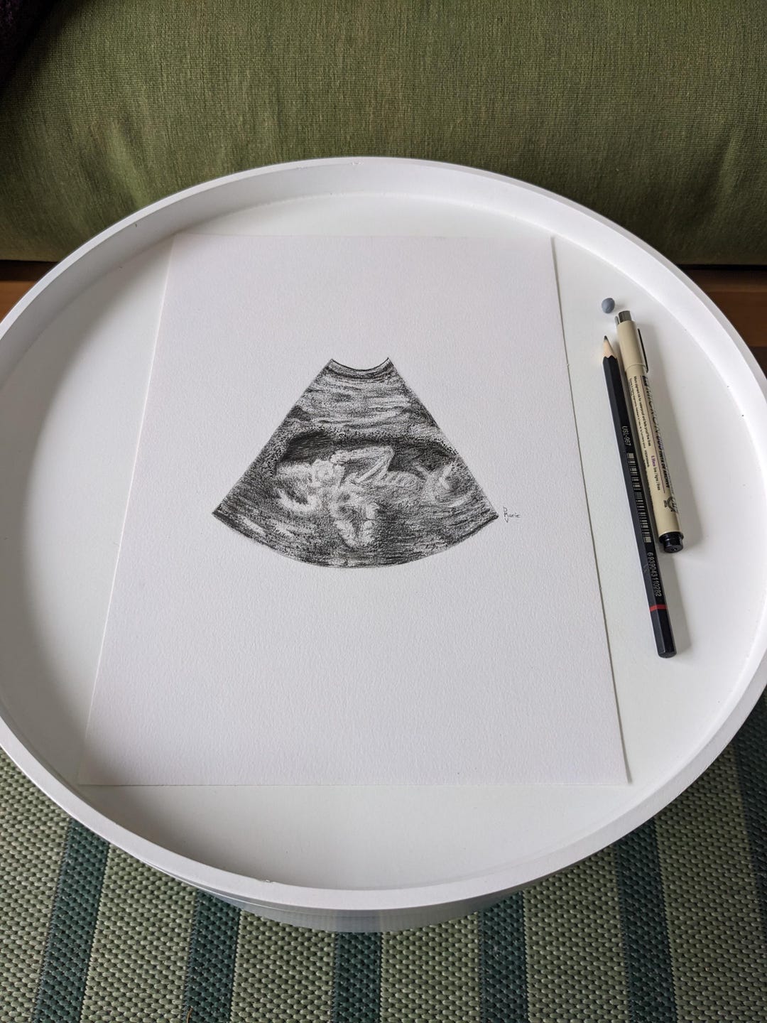 Custom Drawing Sonogram Drawing Made to Order Sonogram Drawing Detailed ...