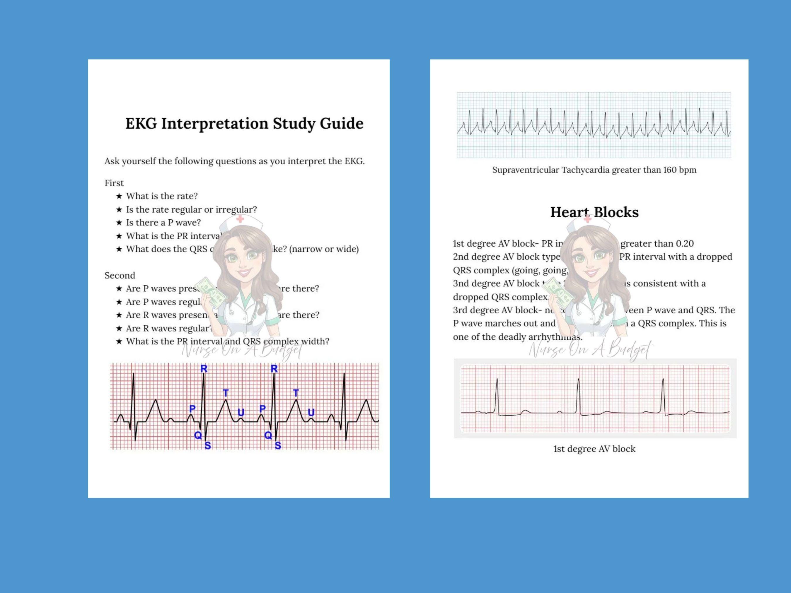EKG Interpretation Study Guide With Practice Strips - Etsy