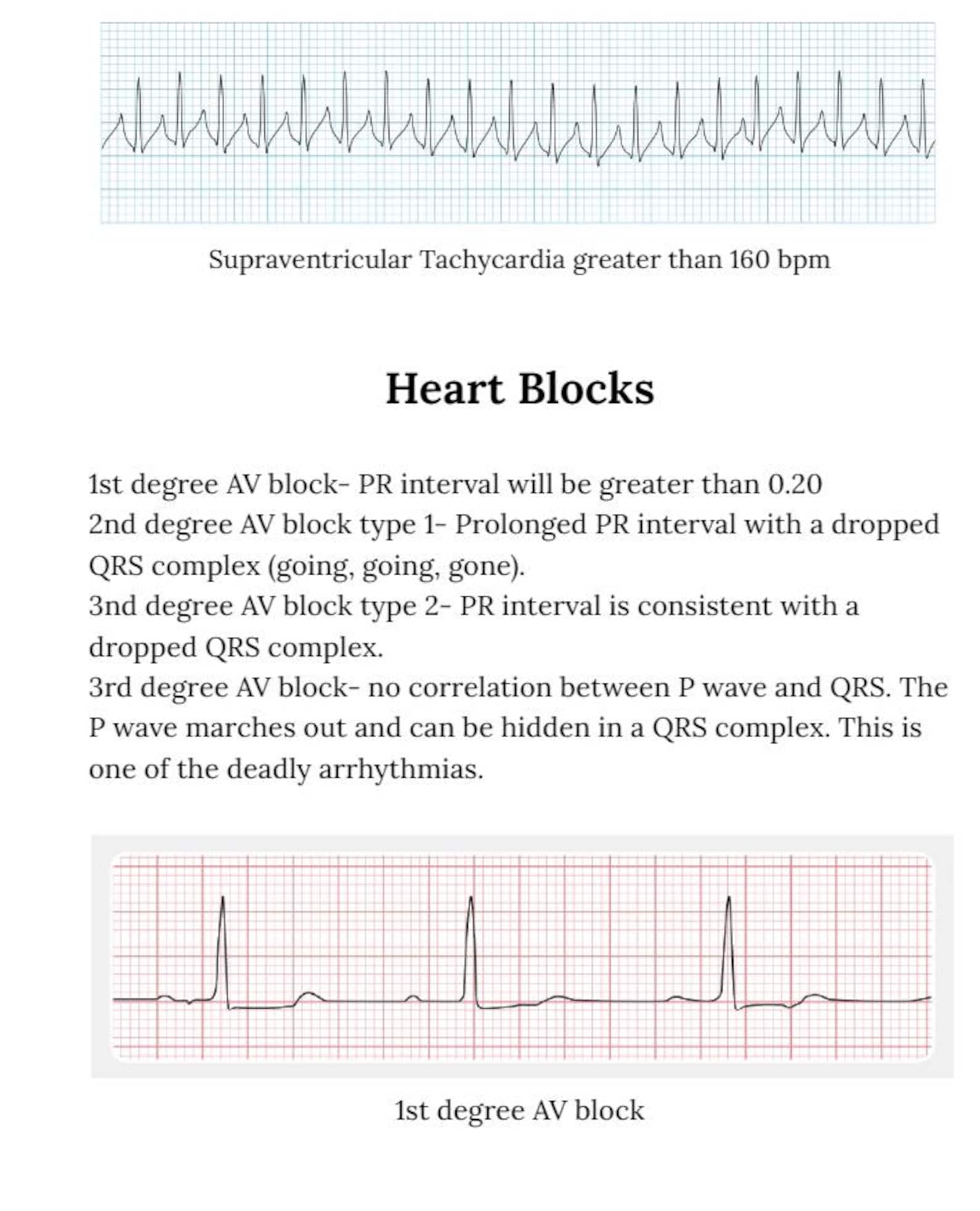 EKG Interpretation Study Guide With Practice Strips - Etsy