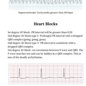 EKG Interpretation Study Guide With Practice Strips - Etsy