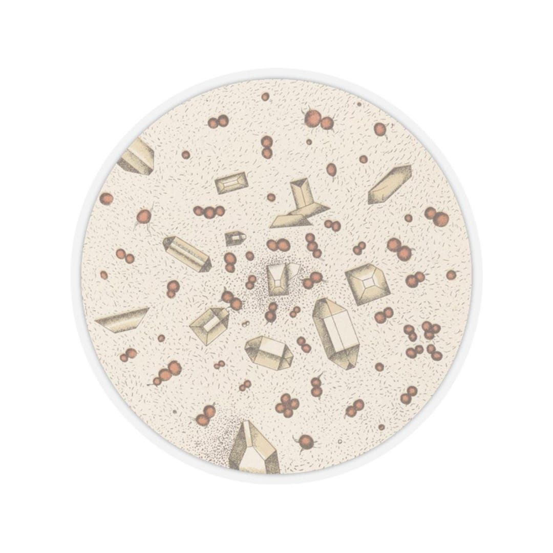 Urine Microscopy With Crystal Stickers. Excellent NEPHROLOGY GIFT or ...