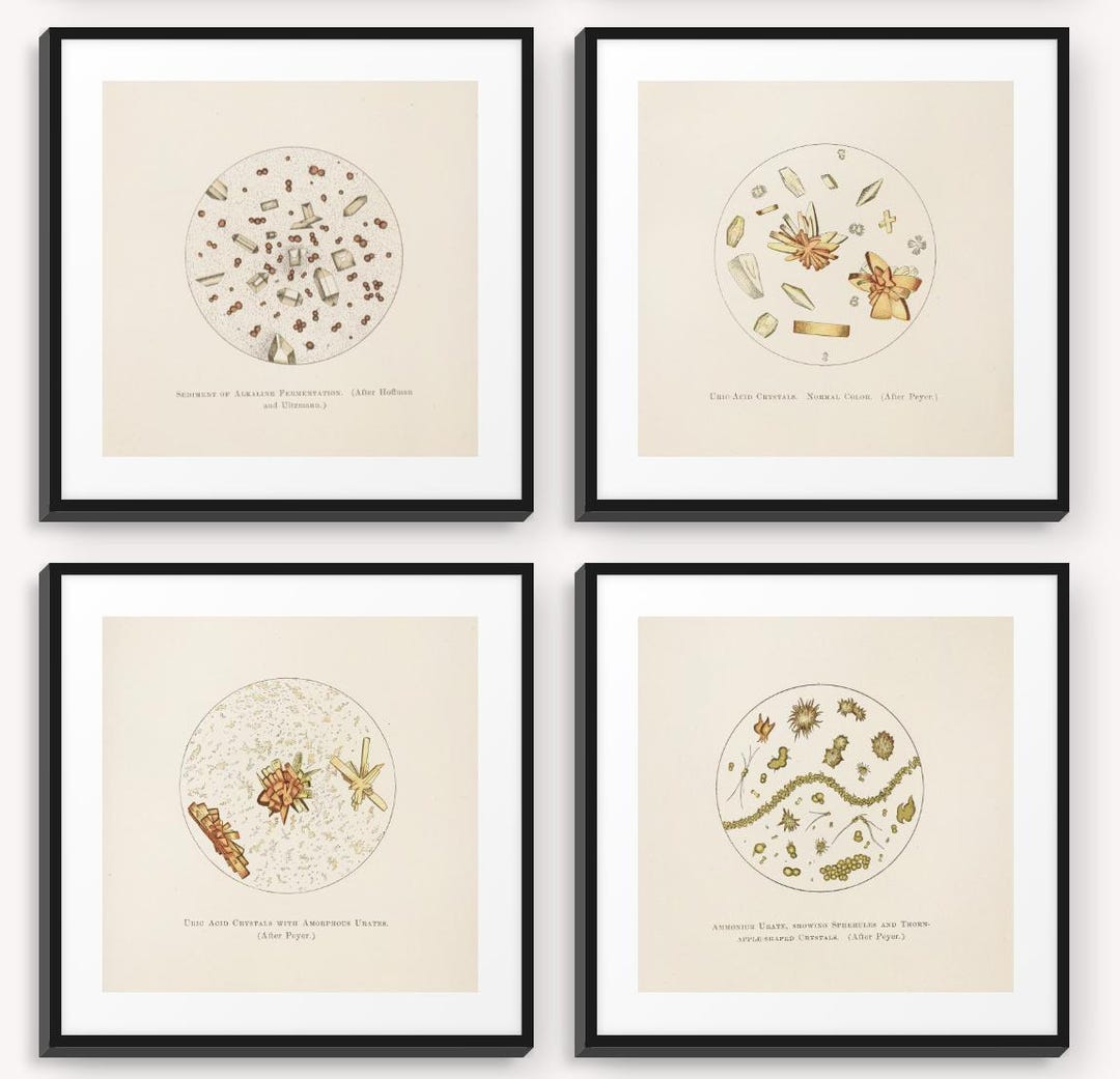 Set of 4 Vintage Urine Microscopy Sediment Prints. Prints, Frames, or ...