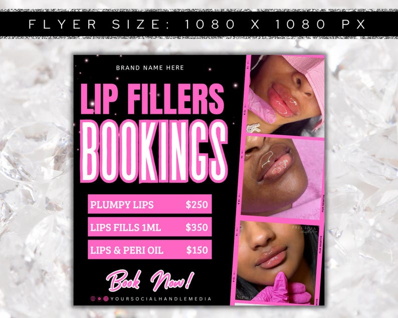Lip Fillers Flyer, Botox Fillers Instagram Post, Digital Templates Lip ...