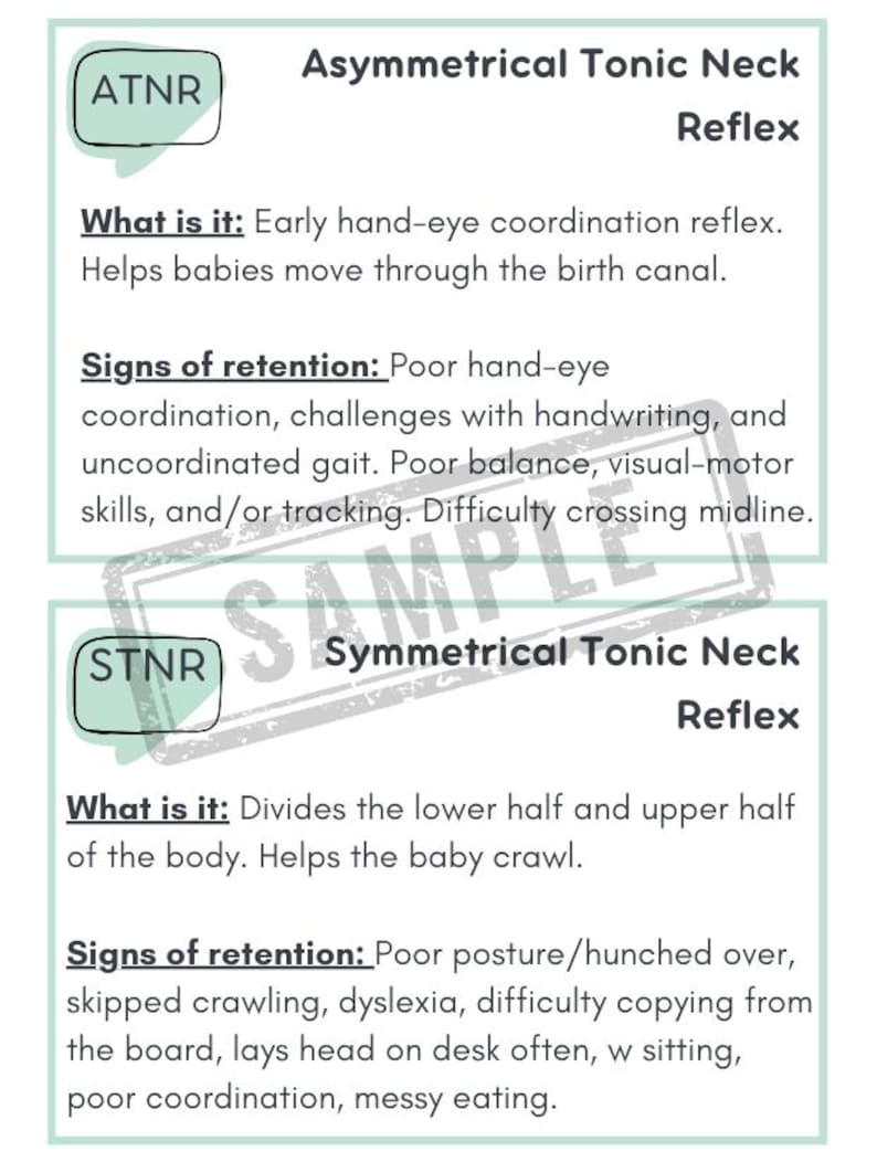 Primitive Reflex Integration Cards - Etsy