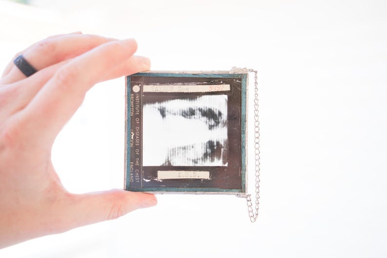 Antique Medical Glass X-ray Slide Institute of Diseases of the Chest ...