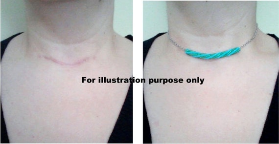 Thyroid Cancer Scar Jewelry