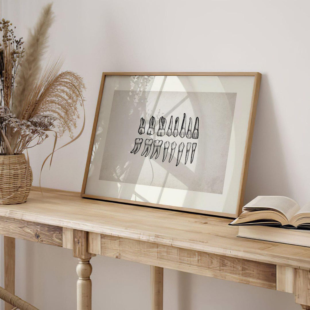 Vintage Teeth Print | Vintage Tooth Anatomy Illustration, Wall Art ...