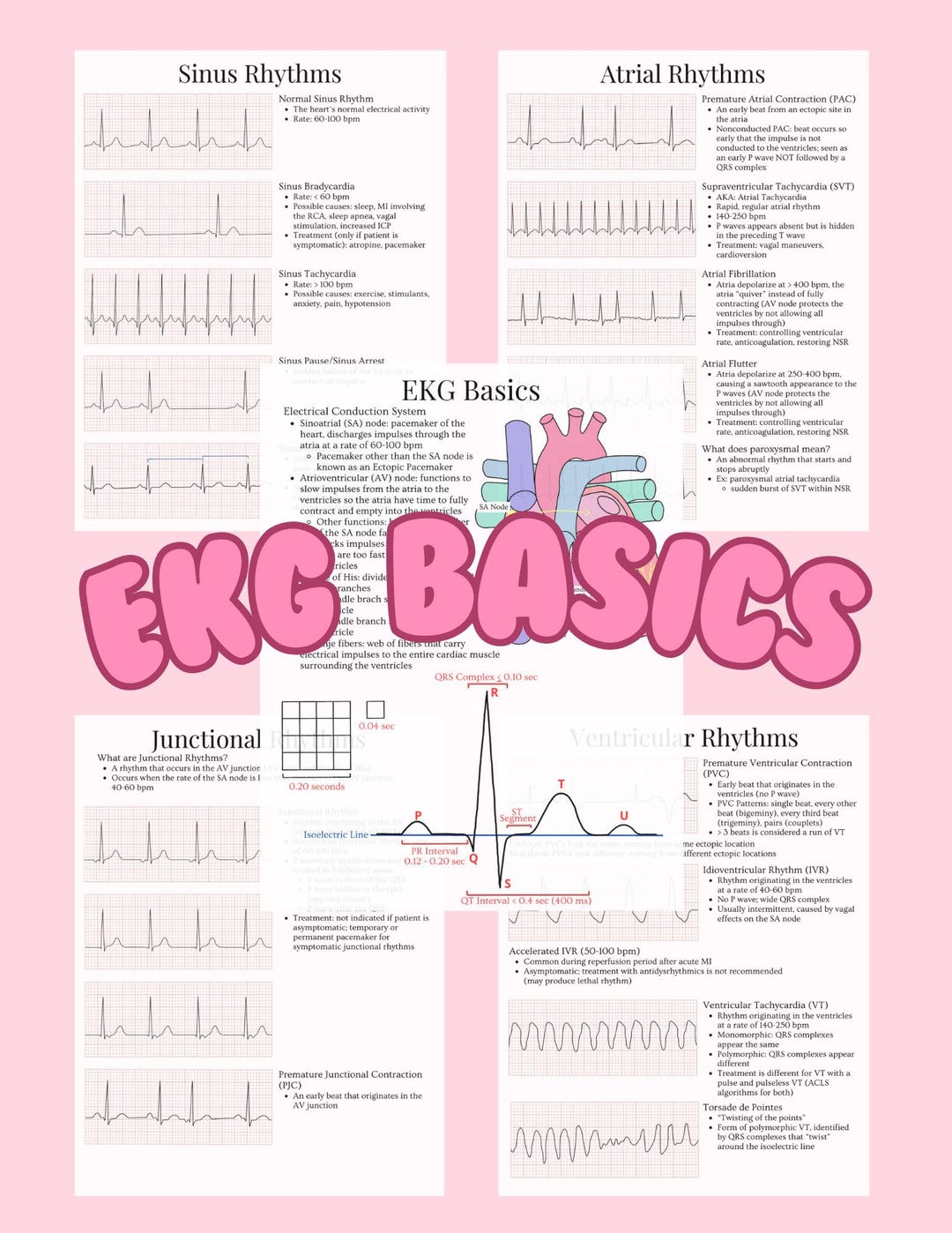 EKG Basics Nursing Notes - Etsy