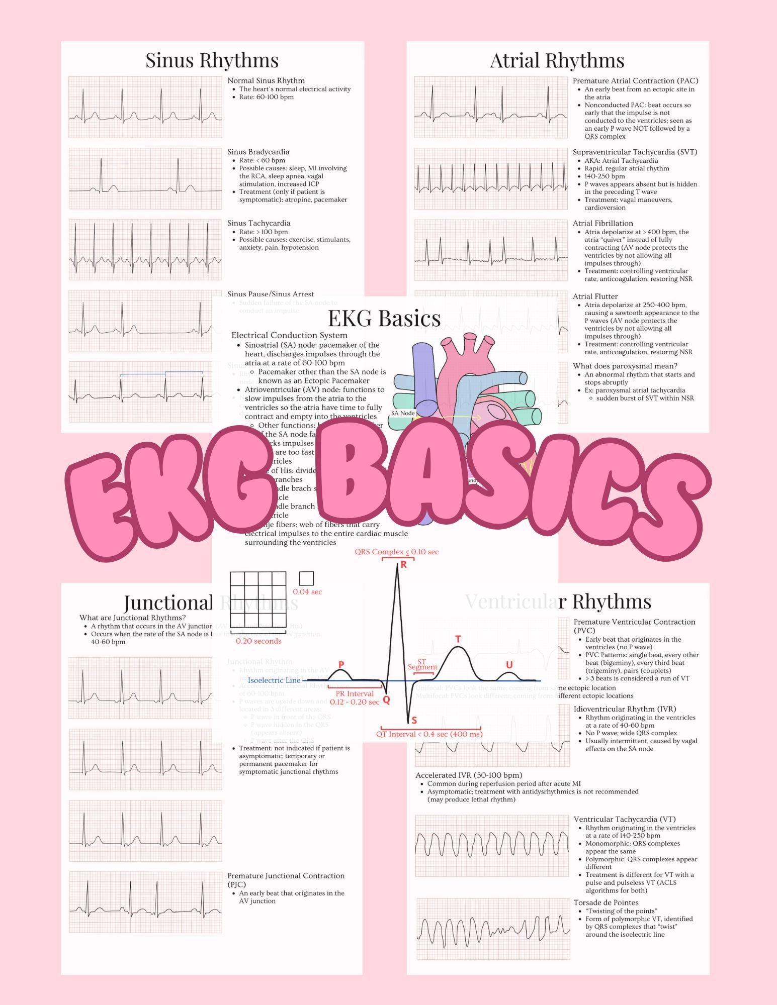 EKG Basics Nursing Notes - Etsy
