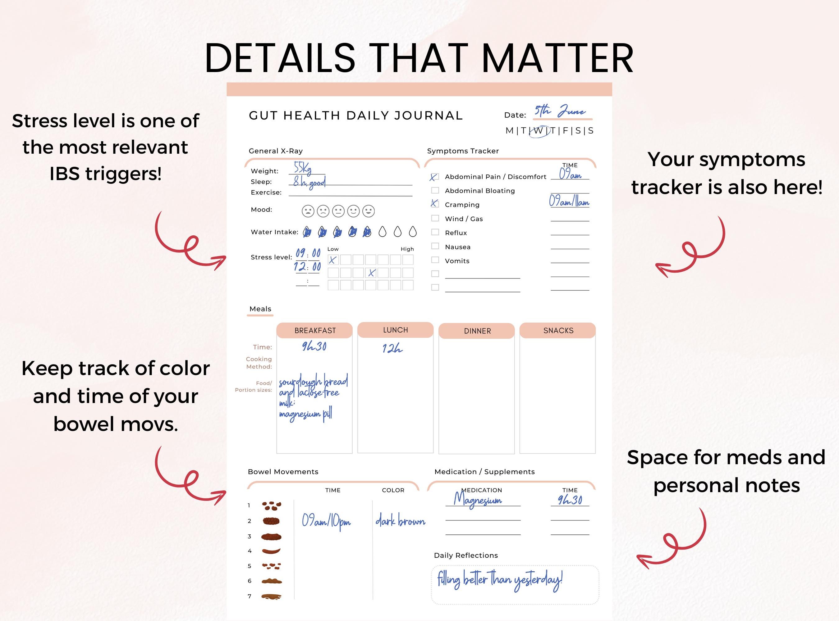 Gut Health Daily Journal, Food Log Printable Template, Symptoms Tracker ...