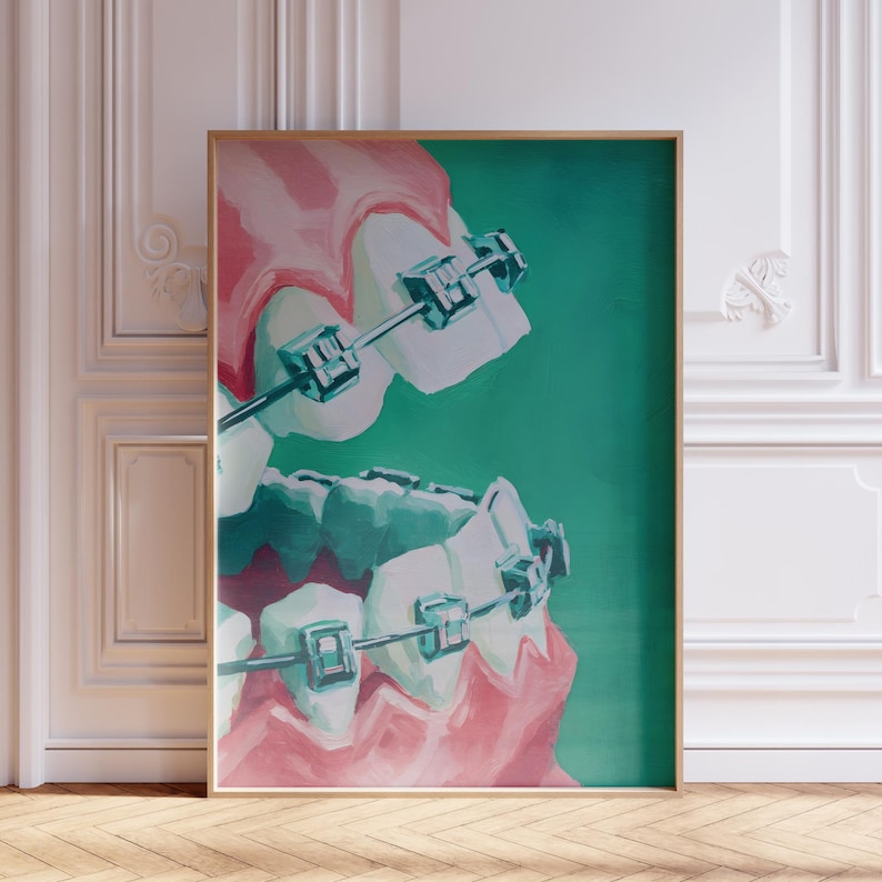 Braces Poster for Dental Room, Dentist Student Teeth Art, Orthodontist ...