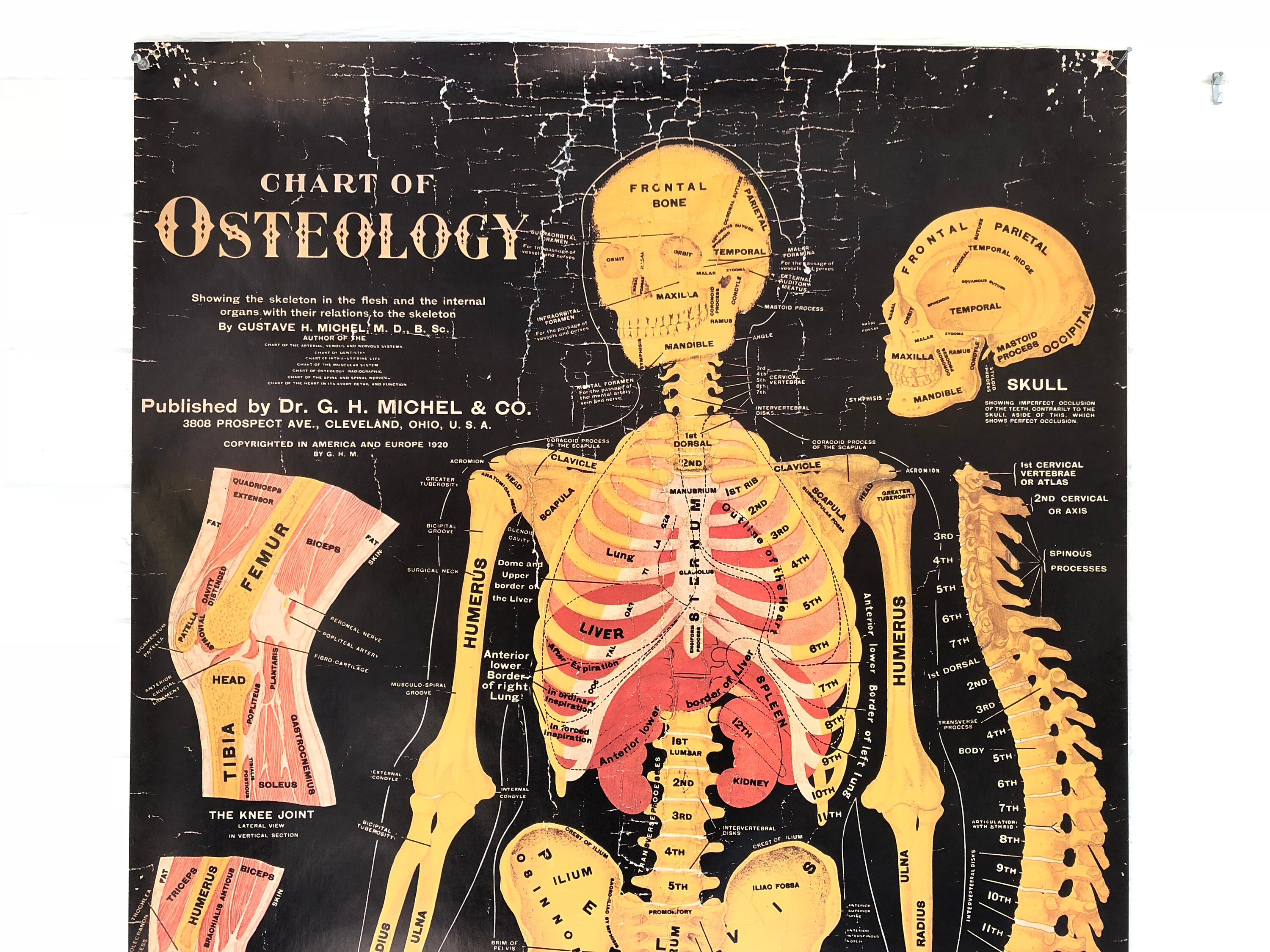 Vintage Chart of Osteology~ Doctor Gustave H. Michel & Co.~ Anatomical ...