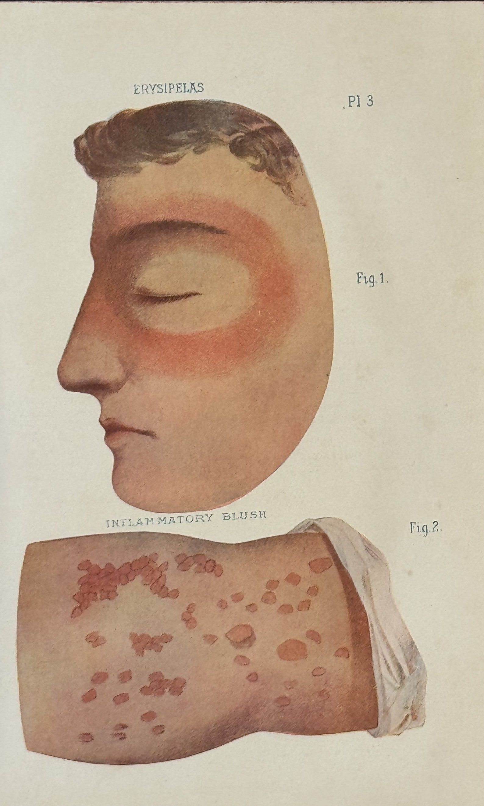 Antique Medical Coloured Plates: 1920s Anatomy and Disease ...