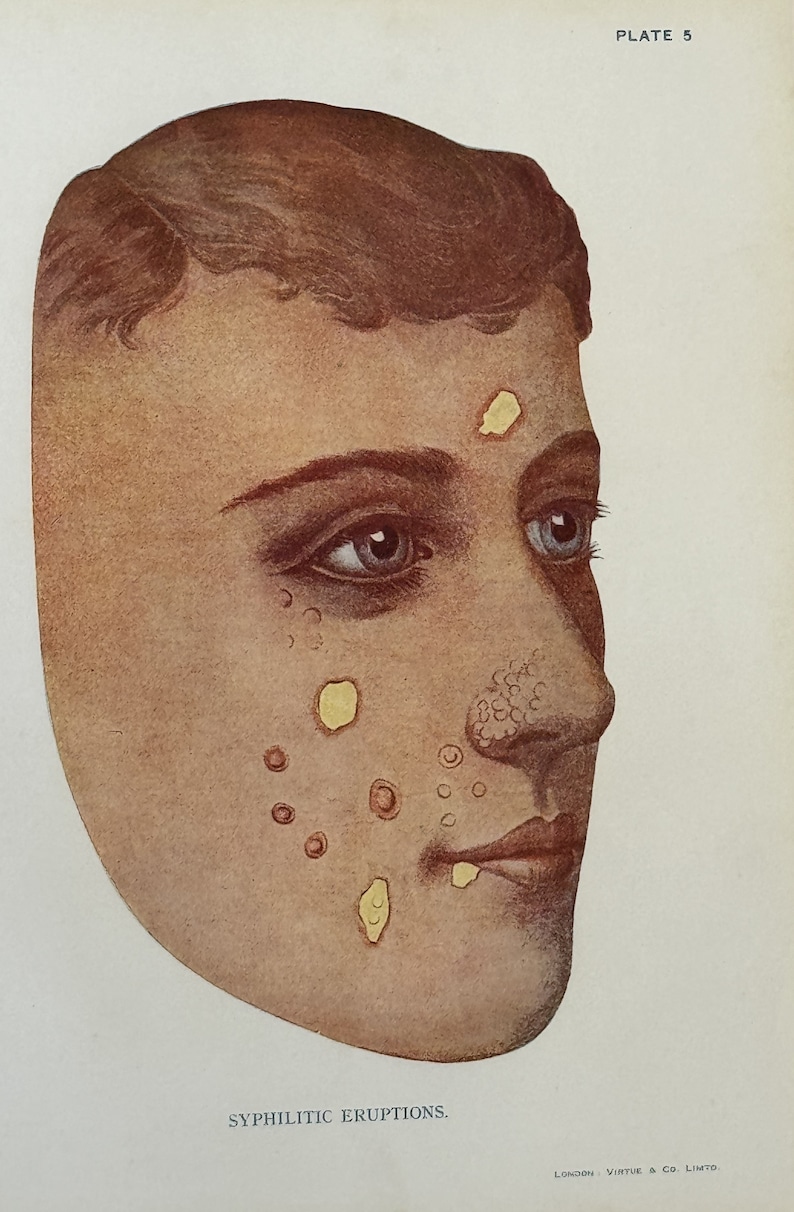 Medical and Anatomical Images From Virtue's Household Physician, 1920's ...