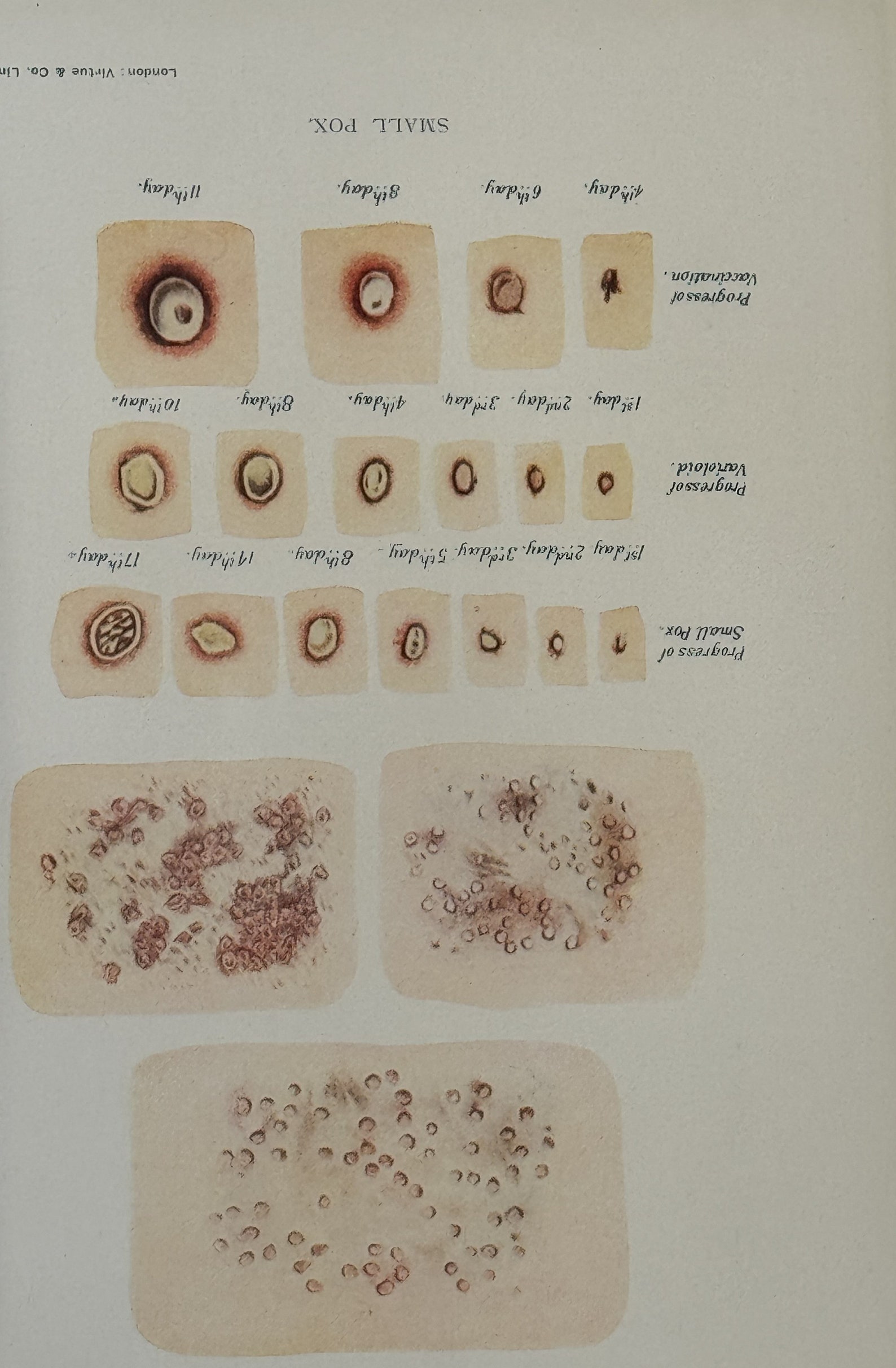 Antique Medical Coloured Plates: 1920s Anatomy and Disease ...