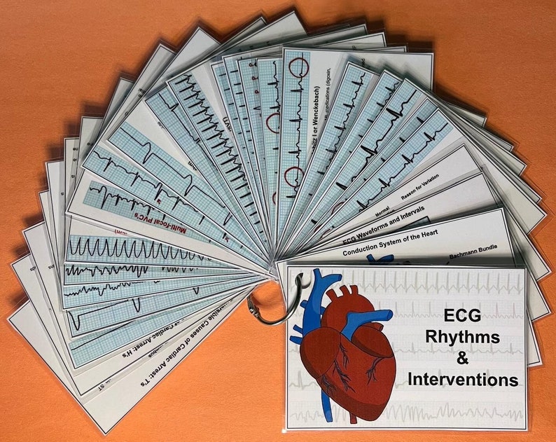 ECG Rhythms and Interventions Flashcards for Nurses, Nursing Students, EMT, Paramedics, Medical ...