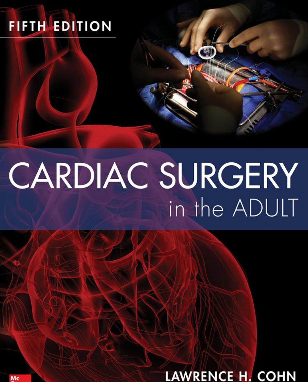 Cardiac Surgery in the Adult by Lawrence H. Cohn, David H. Adams - Etsy