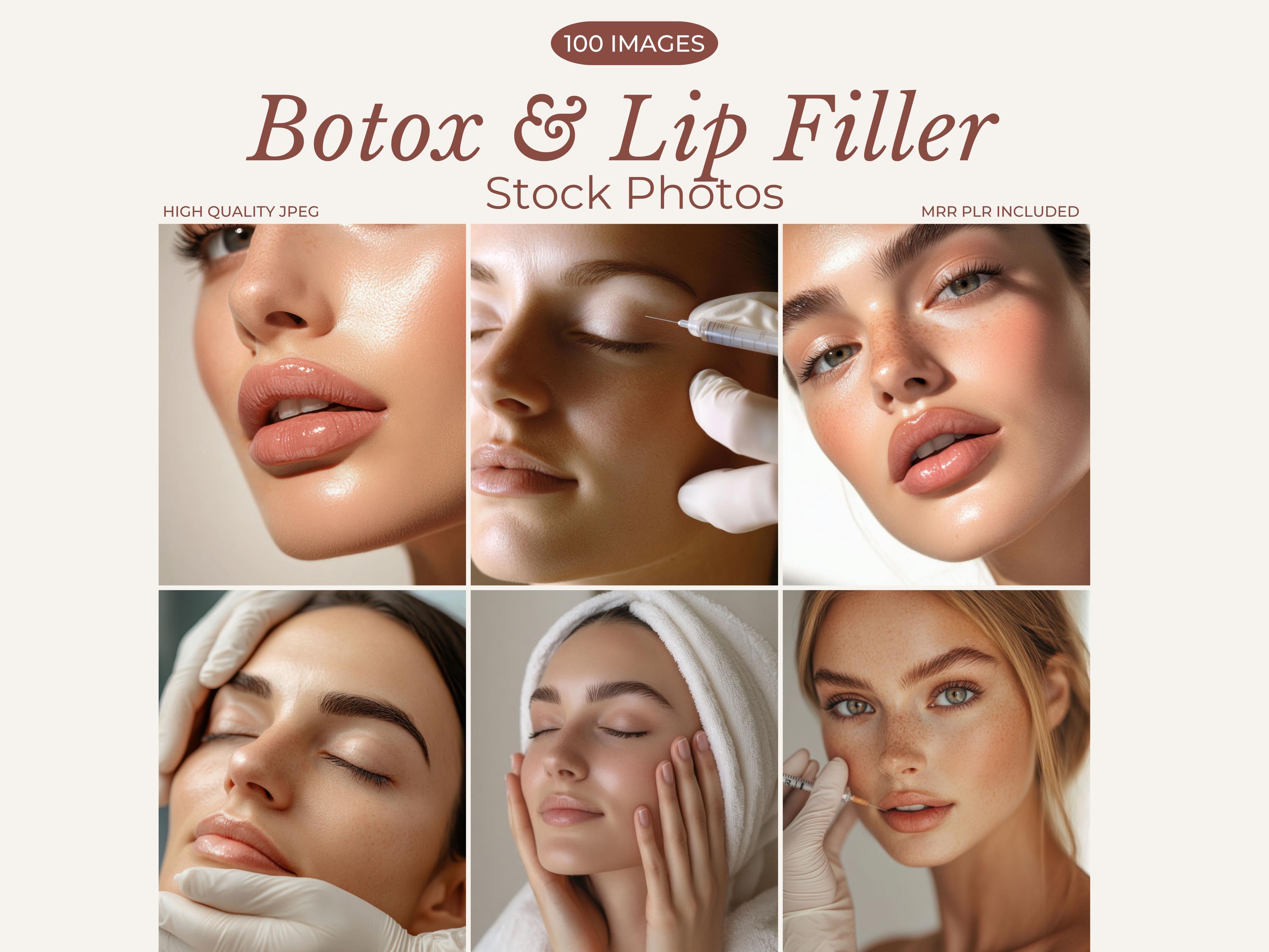 Botox Stock Photos Lip Filler Stock Photos Botox Filler Model Stock ...