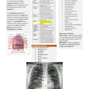 Respiratory System - Anatomy, Chest X-ray Imaging Positioning, Review ...