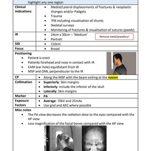 Skull and Facial Bones Positioning Summary Notes for Diagnostic ...