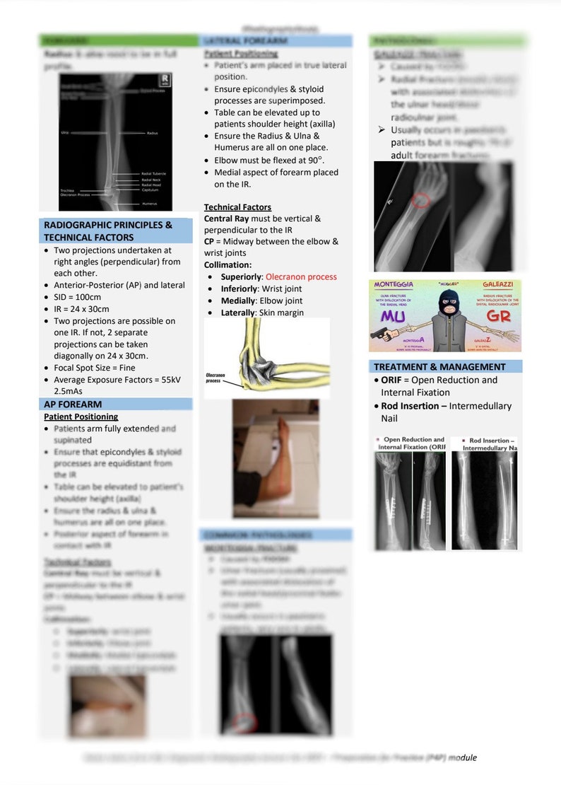 Hand Wrist and Forearm - Anatomy, Positioning and Technique Notes for ...