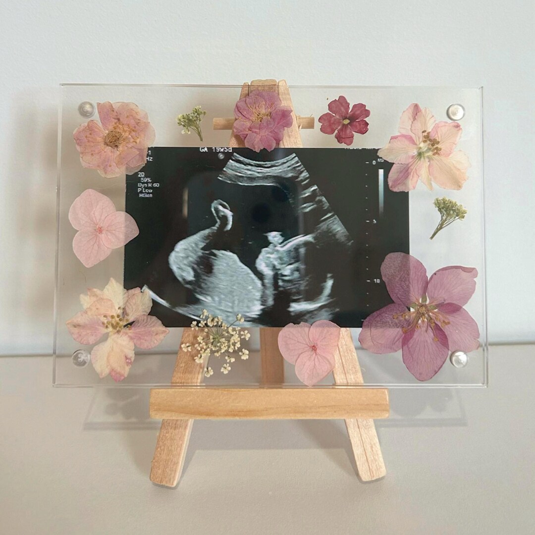 Custom Pressed Flower Acrylic Frame - Etsy