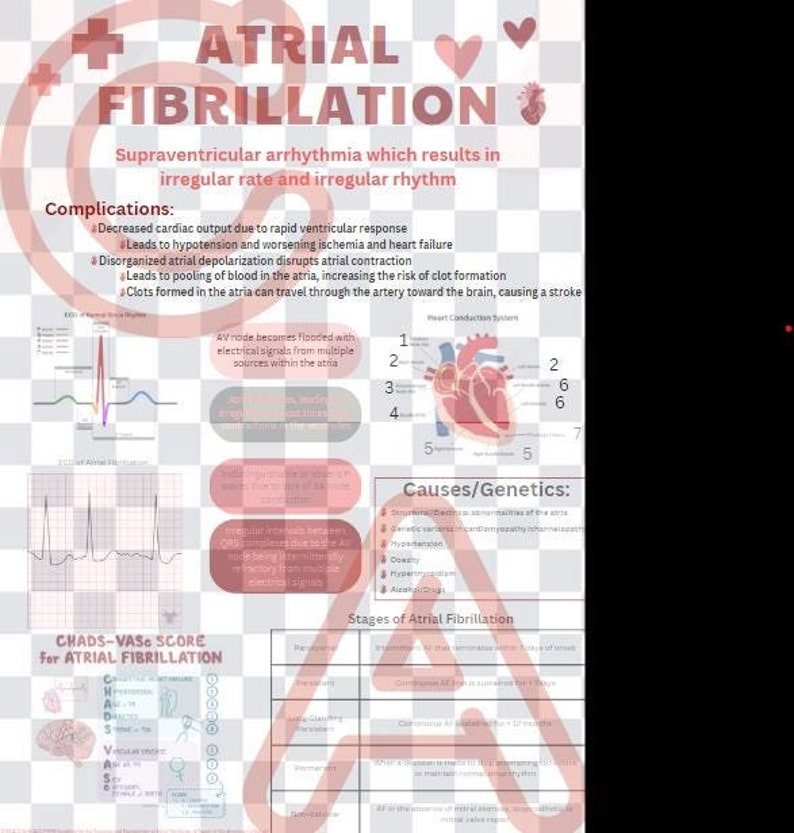 Atrial Fibrillation Study Guide for Pharmacy Students - Etsy
