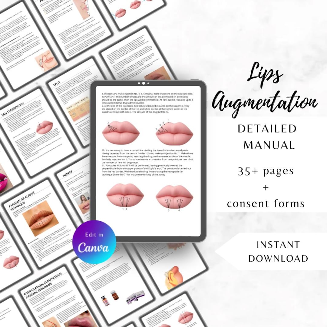 Lip Filler Training Manual + Consent Form | 35-page Lip Augmentation ...
