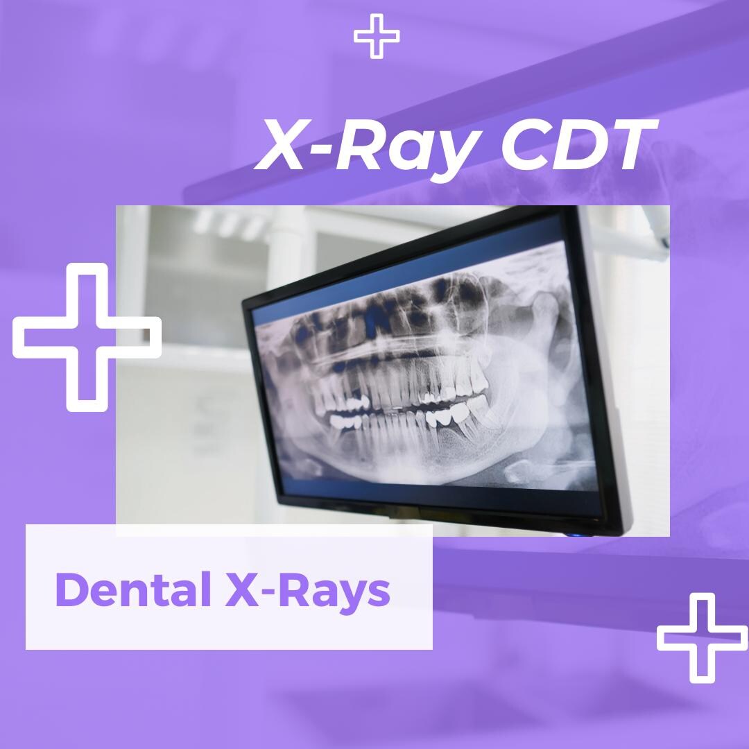 Digital Dental X-ray ADA CDT Codes Study Guide - Etsy