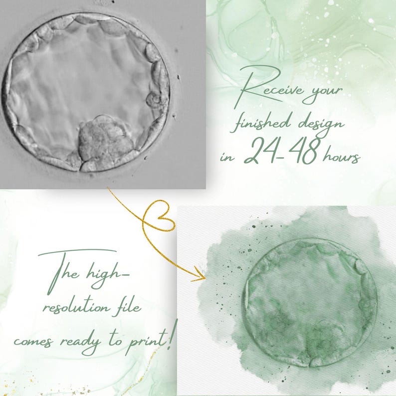 Custom IVF Art Embryo Watercolor | Personalized Pregnancy Gift | Embryo ...