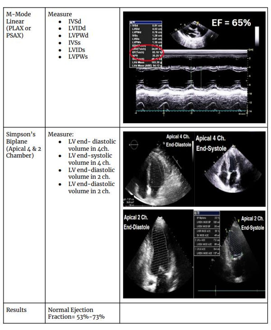 Cardiac Sonography/echocardiography Study Guide/notes - Etsy