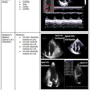 Cardiac Sonography/echocardiography Study Guide/notes - Etsy