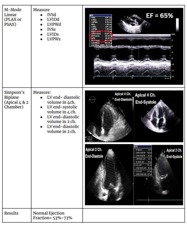 Cardiac Sonography/echocardiography Study Guide/notes - Etsy