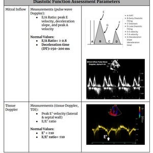 Cardiac Sonography/echocardiography Study Guide/notes - Etsy