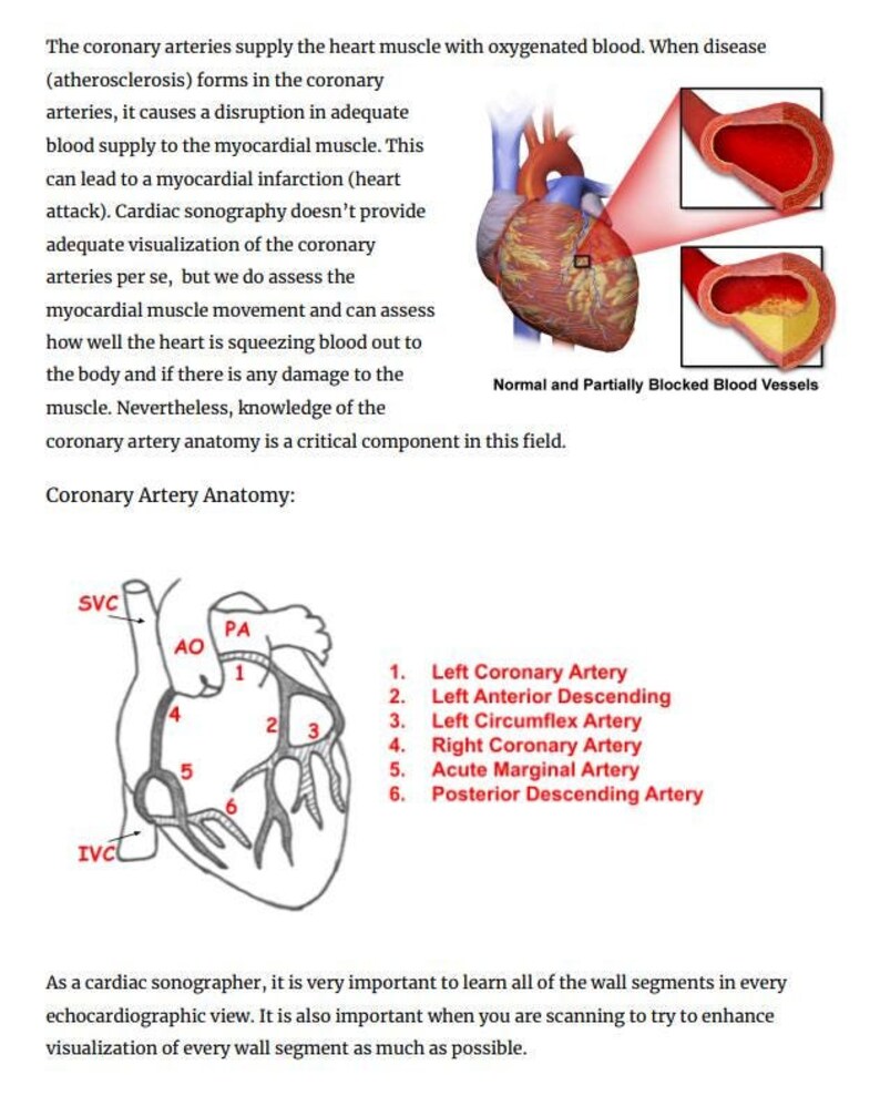 Cardiac Sonography/echocardiography Study Guide/notes - Etsy