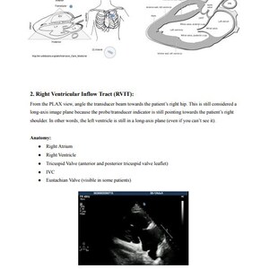 Cardiac Sonography: the Protocol - Etsy