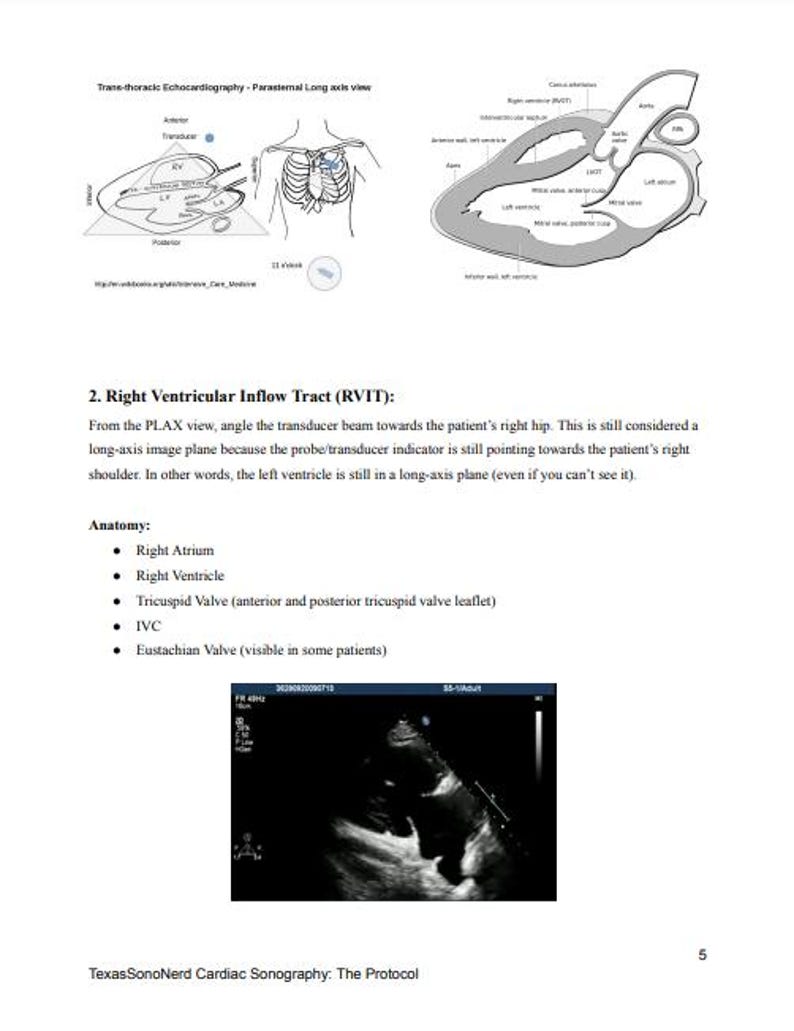 Cardiac Sonography: the Protocol - Etsy
