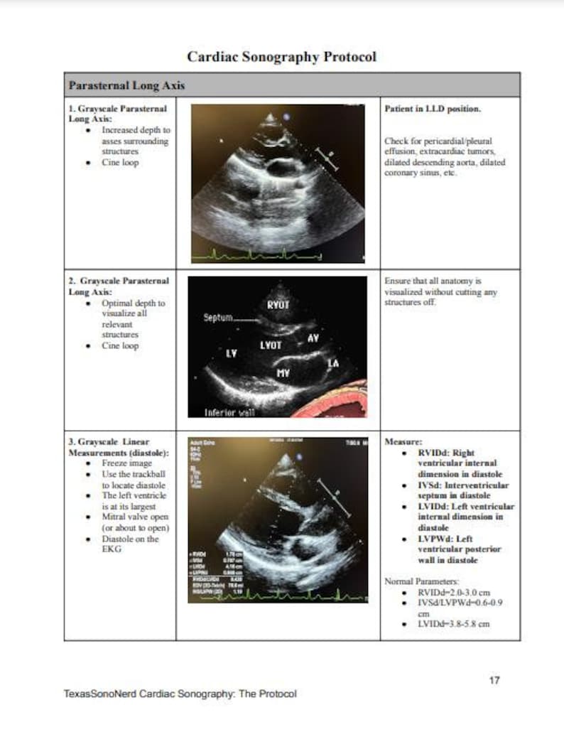 Cardiac Sonography: the Protocol - Etsy