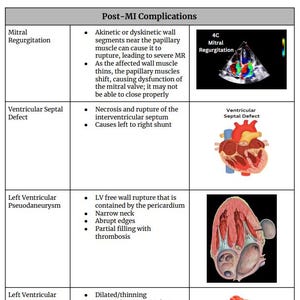 Cardiac Sonography/echocardiography Study Guide/notes - Etsy