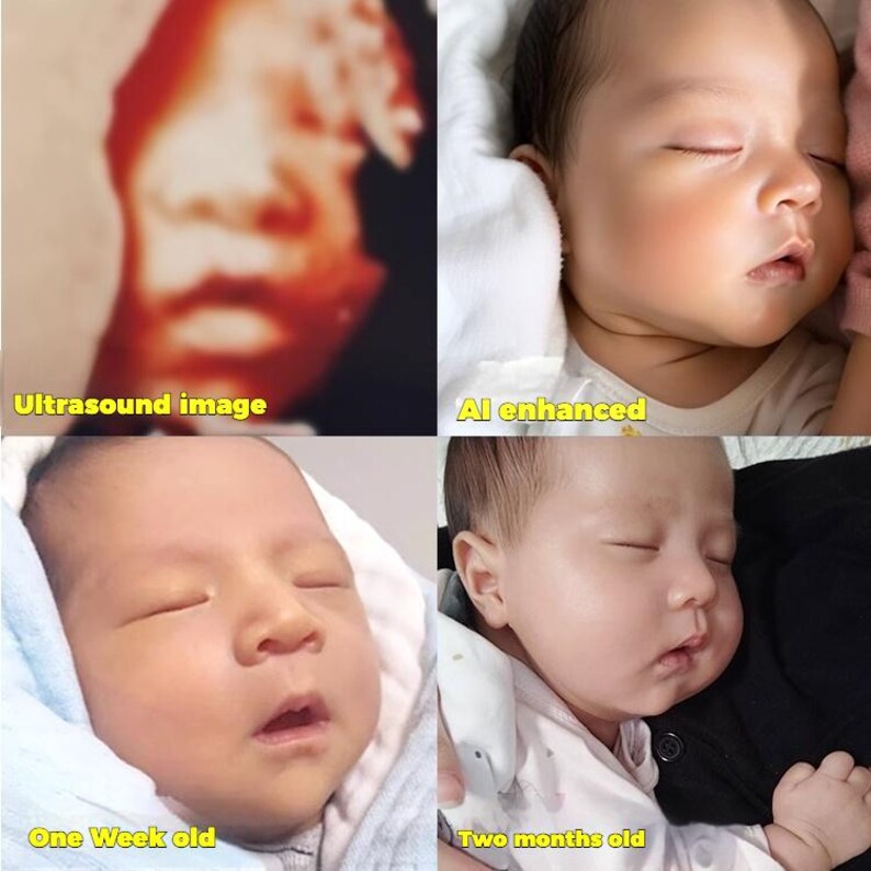 Your Babys First Photo Ultrasound Unborn Baby Illustration Prediction ...