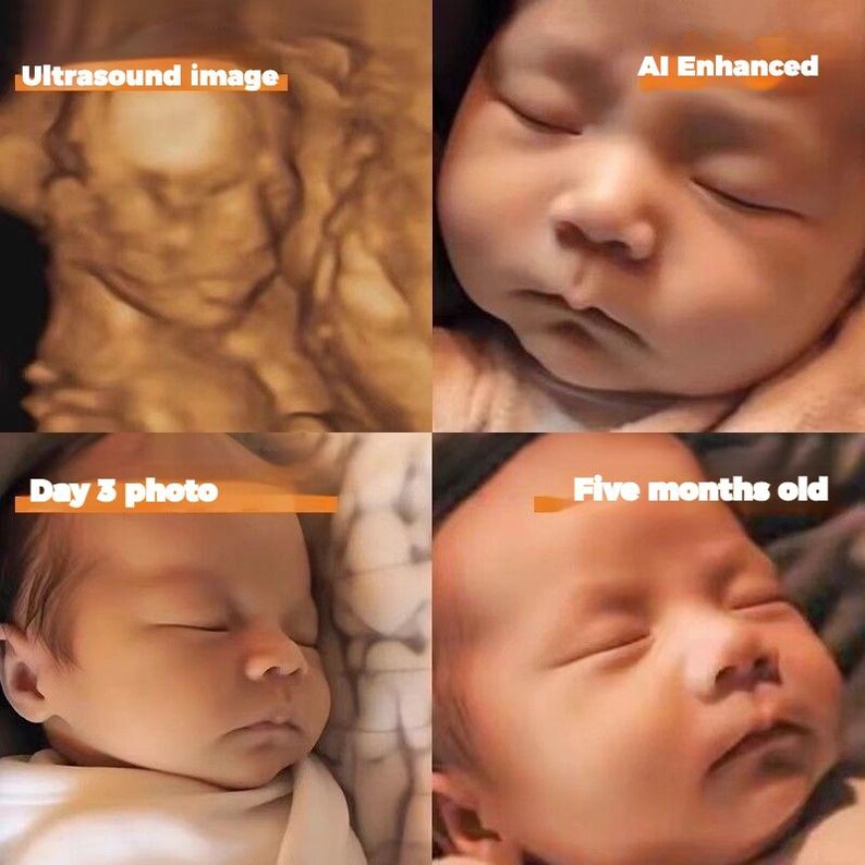 Your Babys First Photo Ultrasound Unborn Baby Illustration Prediction ...