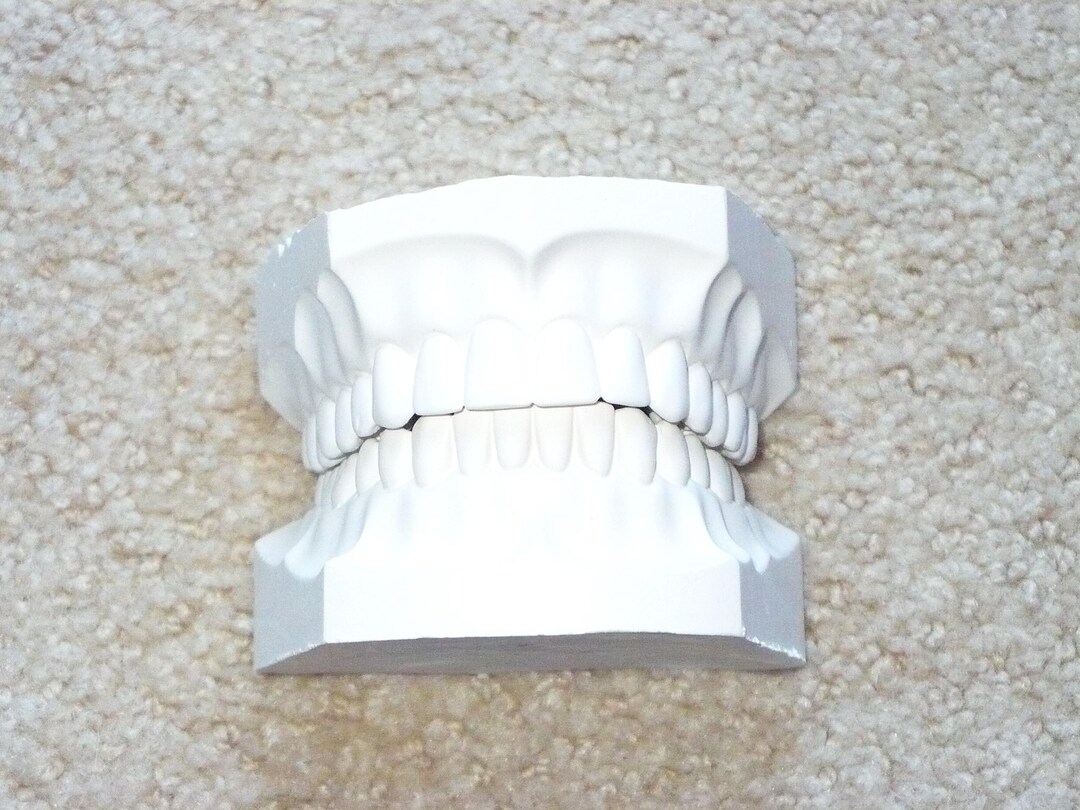 Dental Plaster Cast Full Set of Teeth - Etsy