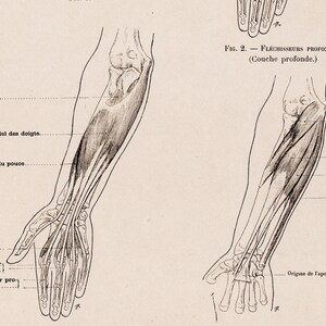 Large Antique French Anatomy Print - Muscles of the Forearm (anterior ...