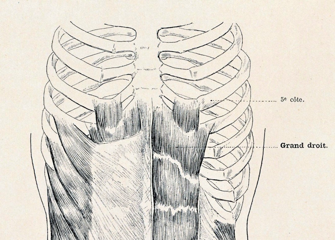 Large Antique French Anatomy Print - Muscles of the Abdomen - Published ...