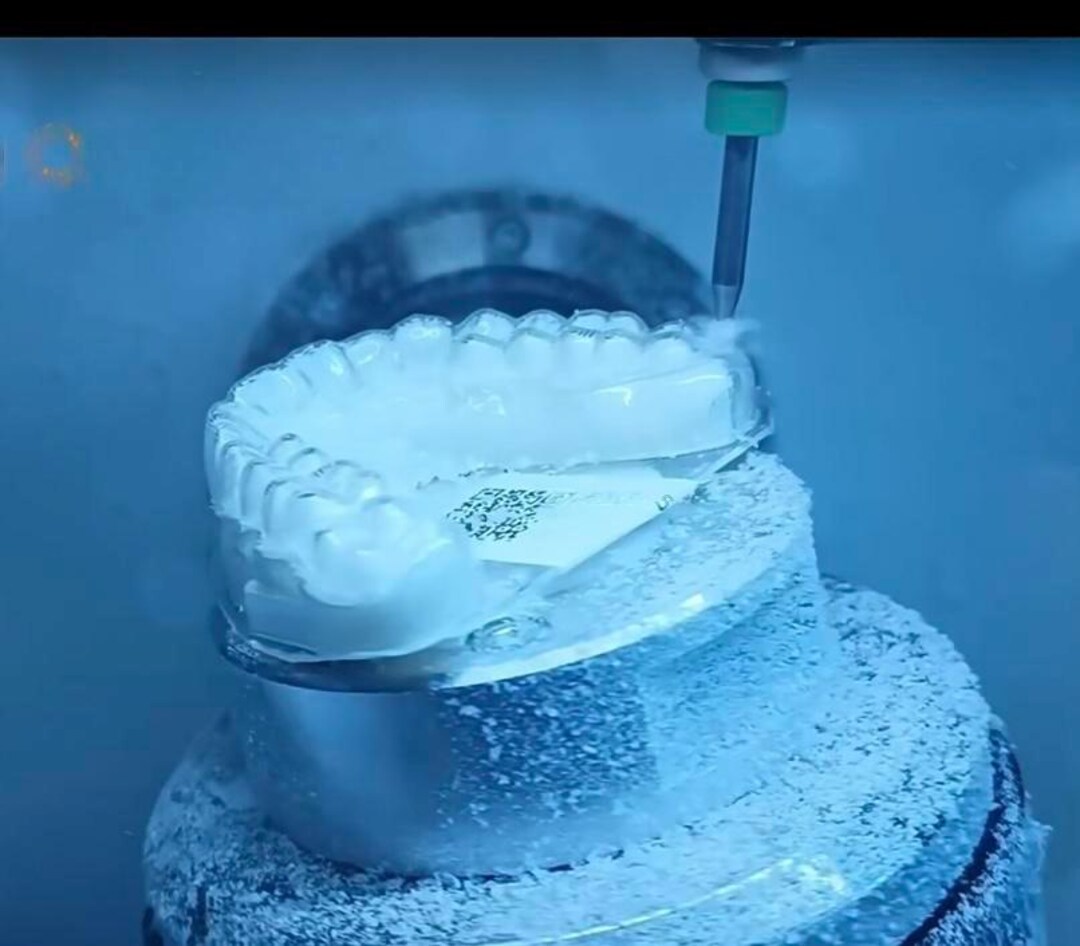 Clear Retainers 3d-printed - Etsy