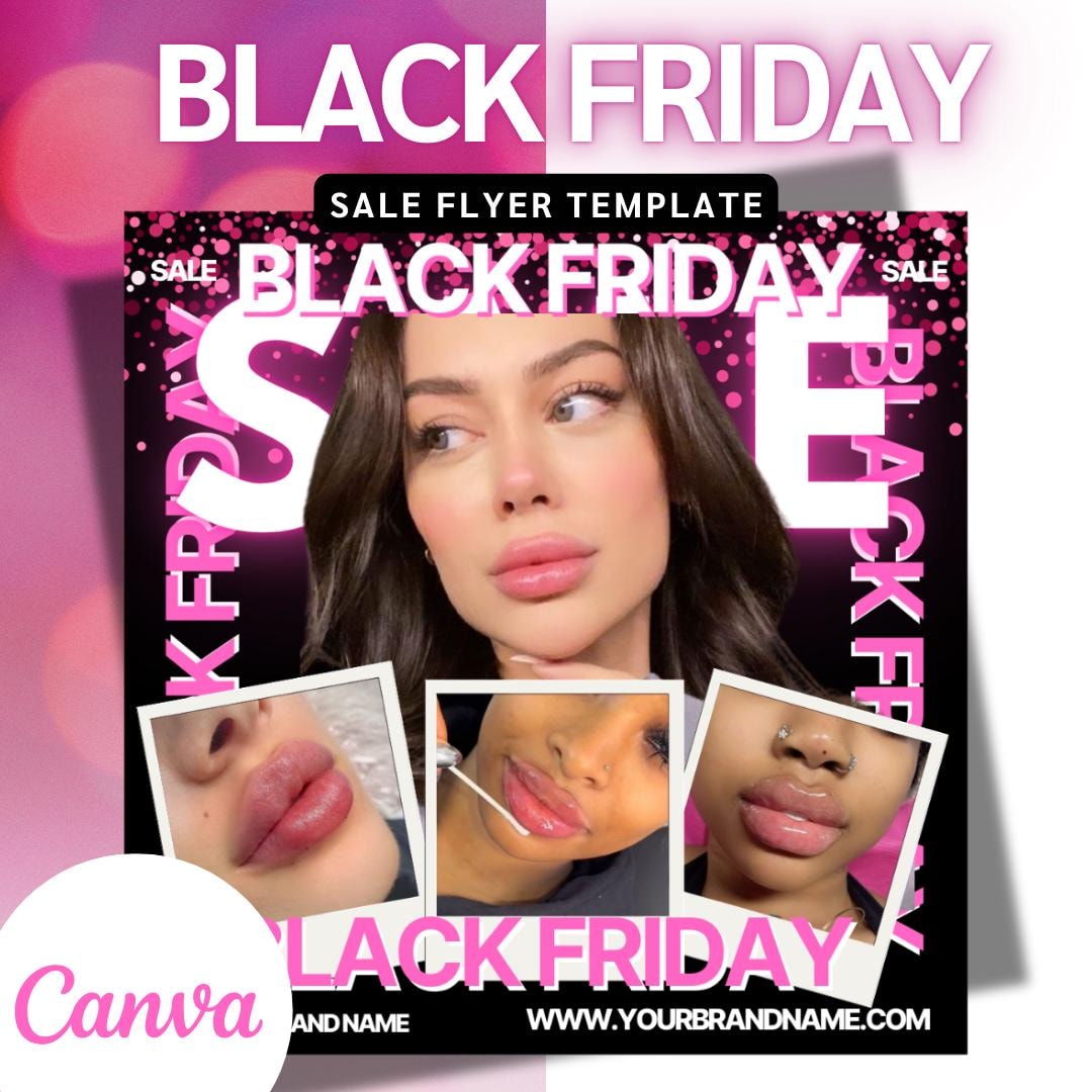 Black Friday Lip Filler Flyer | Black Friday Beauty Boost | Lip Filler ...