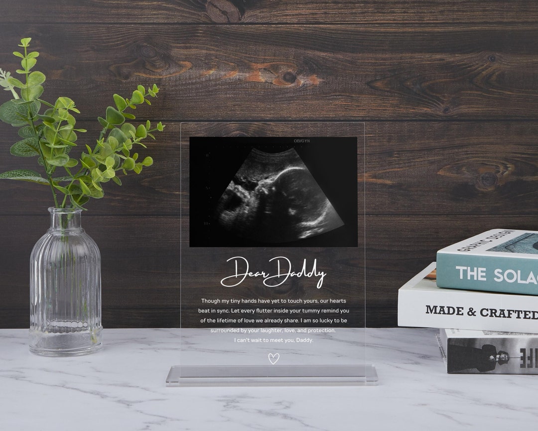 Personalized Ultrasound Picture Acrylic Plaque, Baby Shower Gift ...